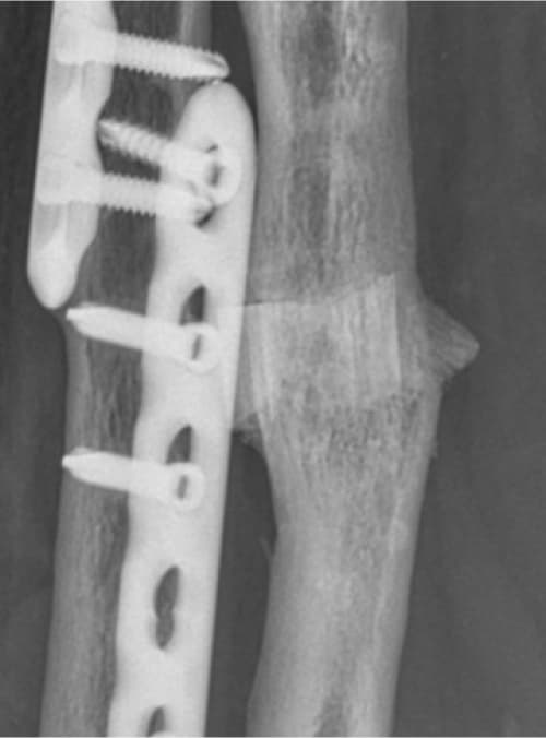 b.Bone Clinical Evidence | CE-marked | Greenbone Ortho