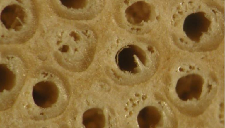 b.Bone for bone regeneration | GreenBone Ortho