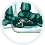 Home | Bone regeneration solutions | GreenBone Ortho